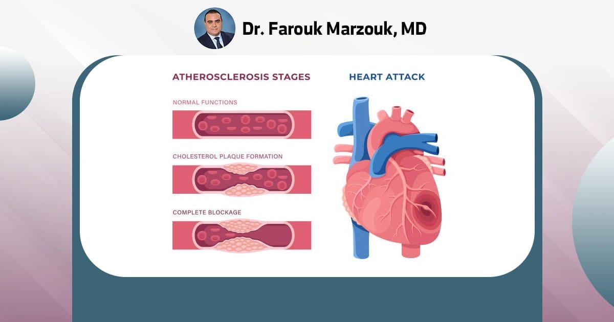 How Serious Is A Blockage Of The Aorta | Farouk Marzouk, MD