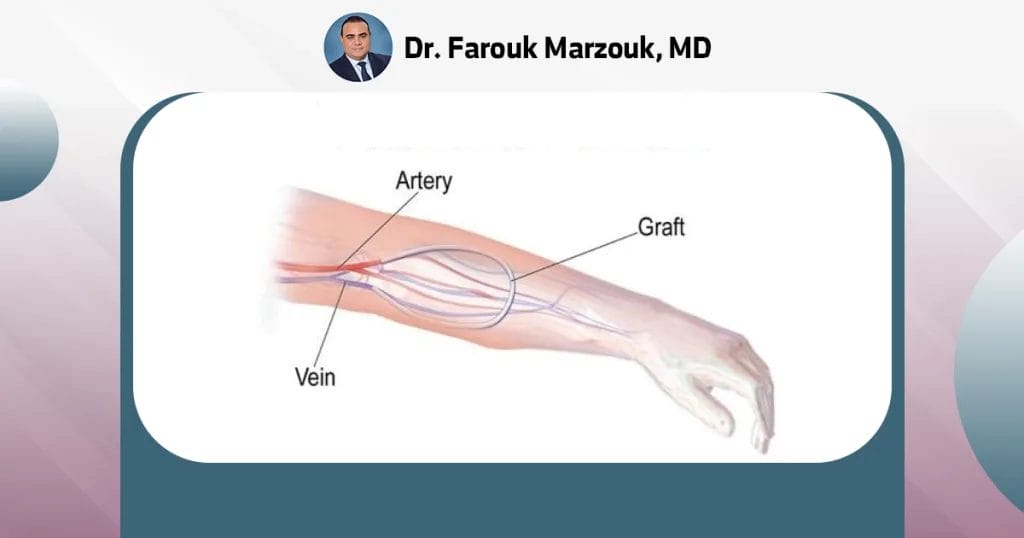 Peripheral Vascular Disease - Farouk Marzouk, MD
