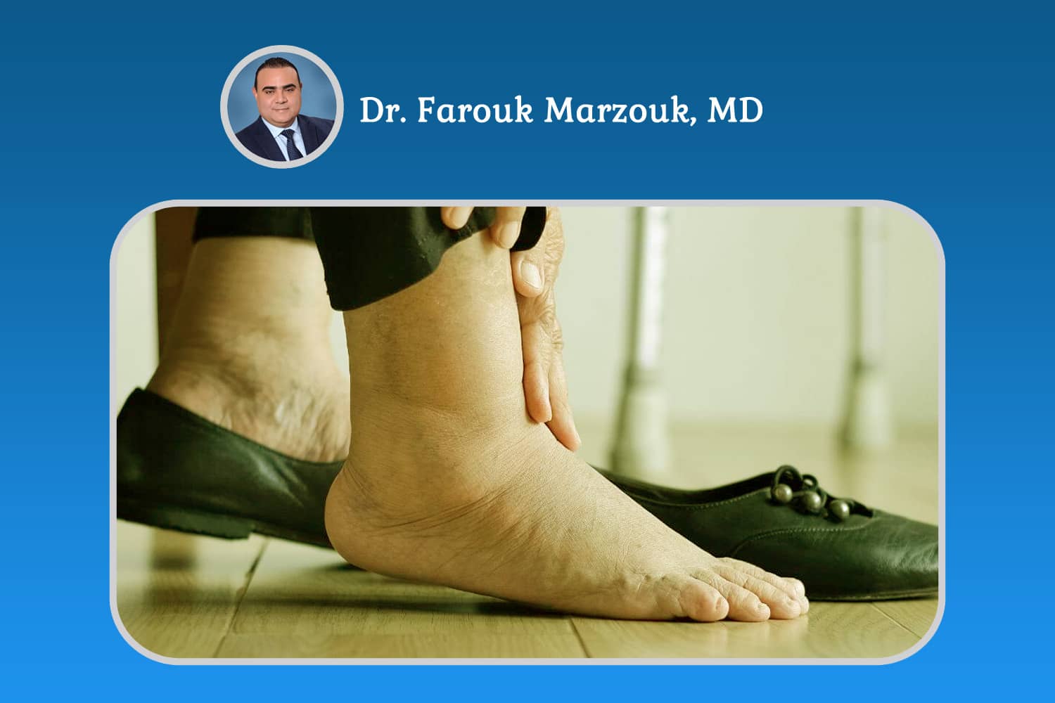 Swelling In Legs Home Remedies - Frontier Medical Care