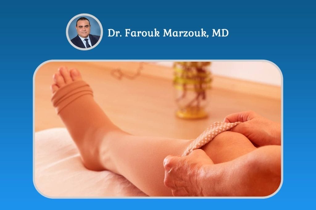 Side Effects Of Wearing Compression Stockings | How To Aviod