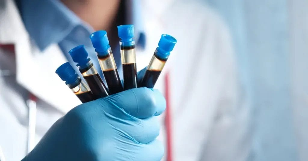 Hematoma Vs Blood Clot | How To Spot The Difference