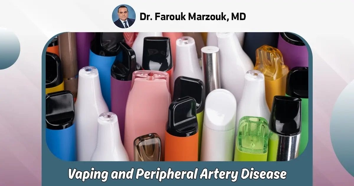 What Is The Best Treatment For Venous Insufficiency