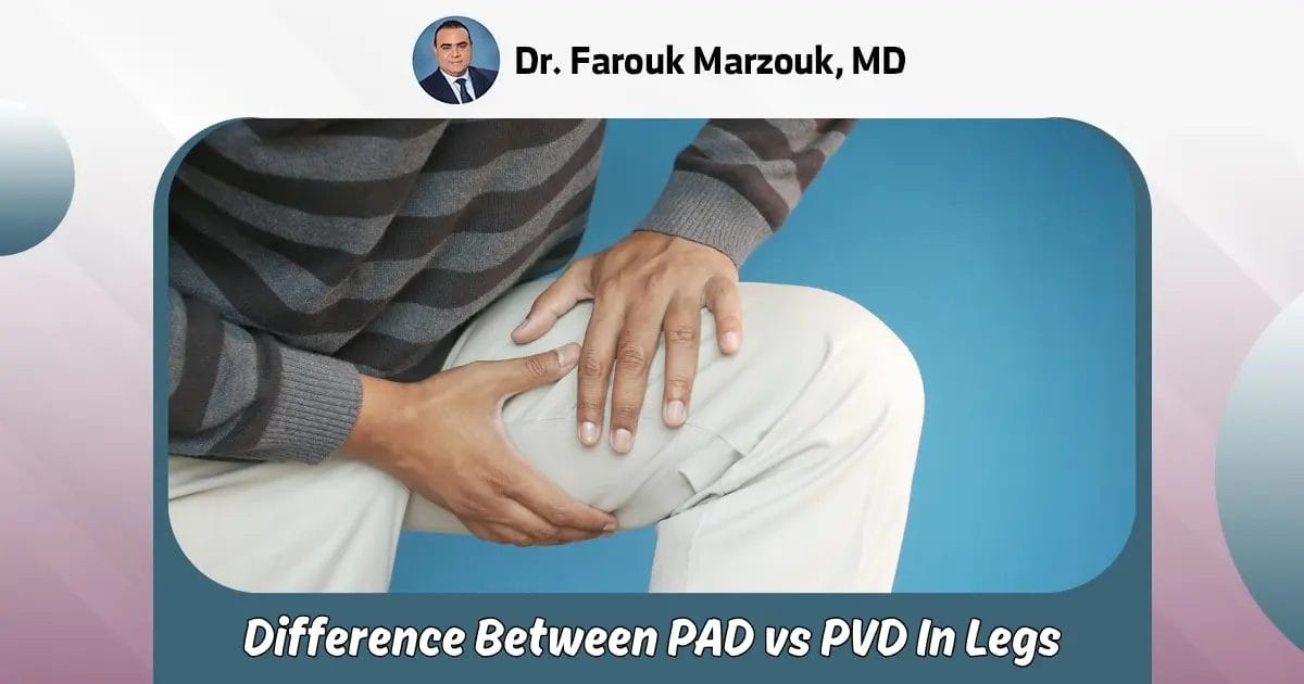 PVD Vs PAD | Difference Between PAD Vs PVD Legs