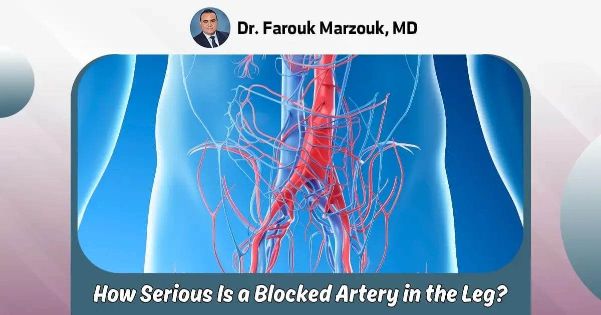 Blocked Artery In Neck: Symptoms, Risks, And Treatment
